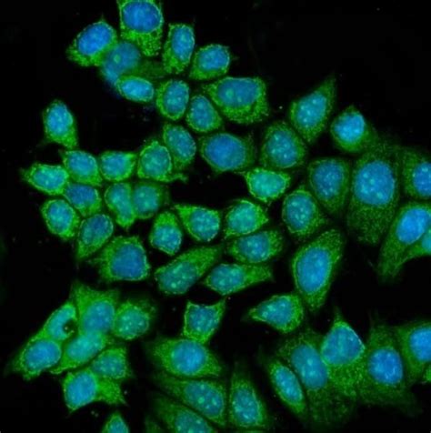 Rcc2 Polyclonal Antibody Invitrogen 100 μg Unconjugatedantibodies