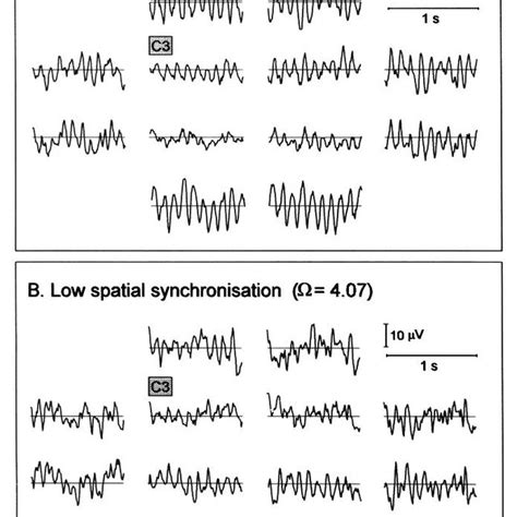 Eeg Common Average Reference At 12 Electrodes Overlying The Left Download Scientific Diagram