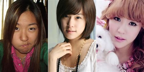 Jangan Kaget Inilah Wajah Artis Korea Sebelum Dan Sesudah Operasi