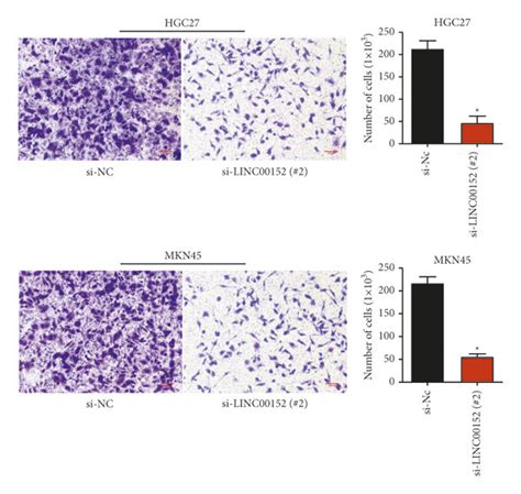 Knockdown Of Linc00152 In Hgc27 And Mkn45 Cells Inhibits Gc Cell