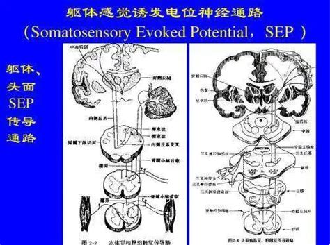 体感诱发电位联合肌电图为脊髓肿瘤手术保驾护航 宝鸡高新医院