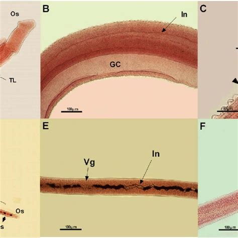 Photomicrographs Of Male A 5x And B 40x And Female C 5x And D