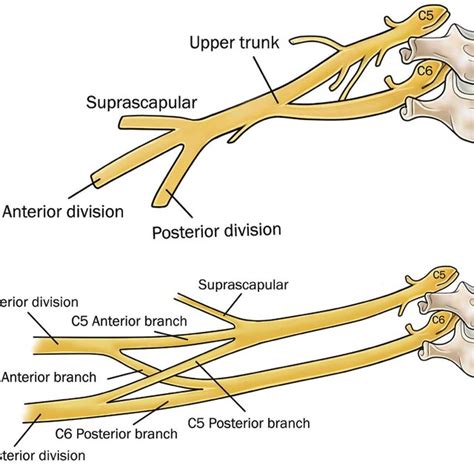 A The Anterolateral Gutter Is Demarcated Superiorly By The Inferior