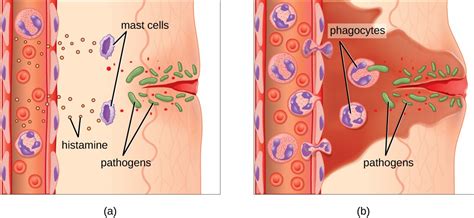 Inflammation And Fever Microbiology