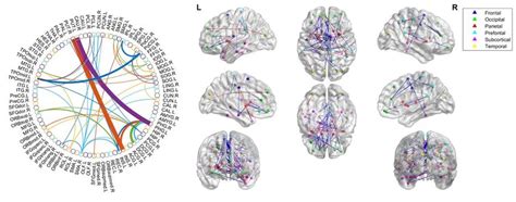 The Most Consensus Connections The Most Consensus Connections Mapped On