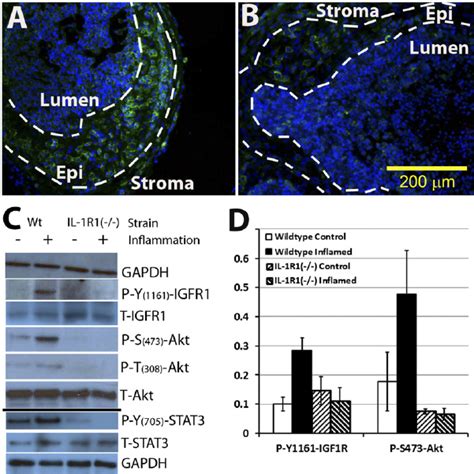 The Igf Signaling Pathway Is Activated In The Prostatic Epithelium