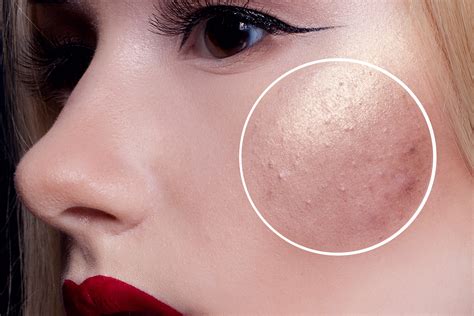 Before And After Cosmetic Operation Young Pretty Woman Portrait