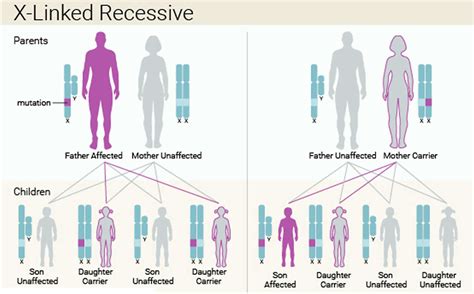 Is Down Syndrome X Linked At Amy Kent Blog