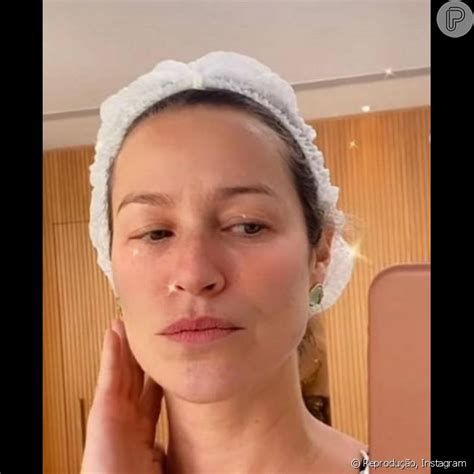 Luana Piovani fez harmonização facial e compartilhou resultado