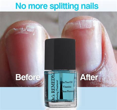 Drs Remedy Sos Nailcare Pack Dlt Podiatry