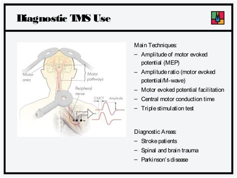 Tms For Beginners