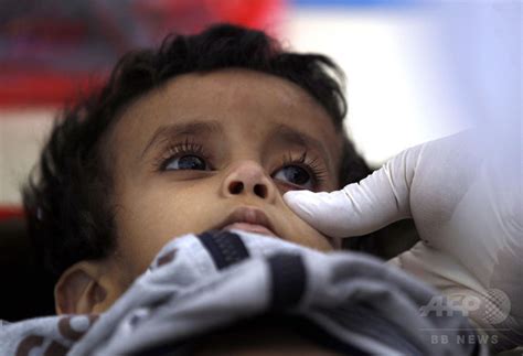 イエメンのコレラ流行、感染疑い10万人超 死者789人に Who 写真4枚 国際ニュース：afpbb News