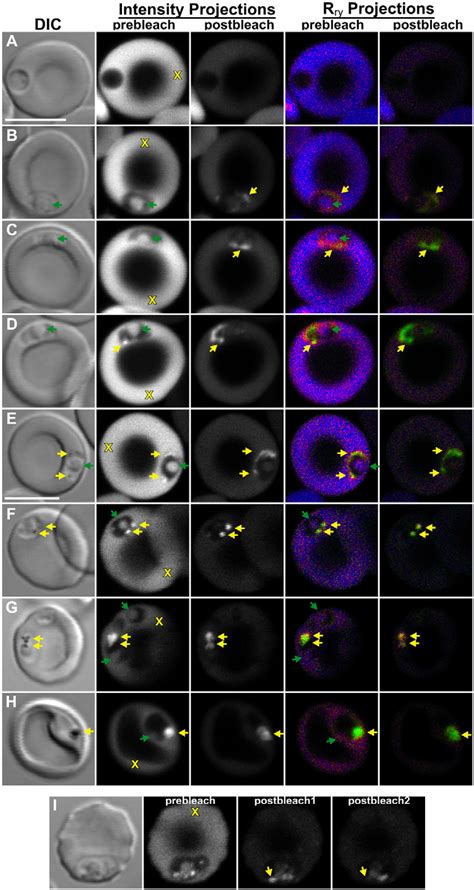 Figure 2 From Digestive Vacuole Genesis And Endocytic Processes In The