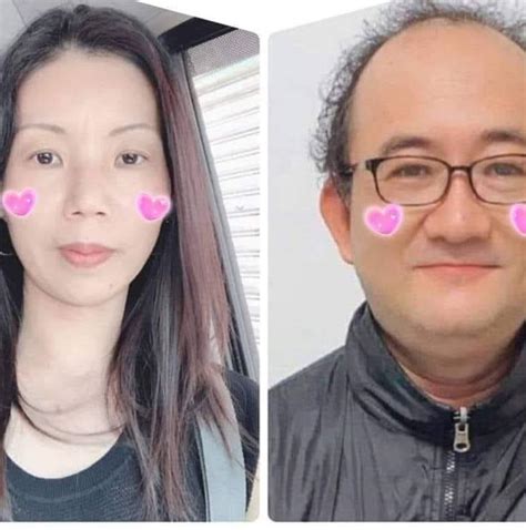 Forte來自長庚醫學團隊 「無論你幾歲，都要愛當下的自己！」 「使用一兩個禮拜之後，就會感覺到皮膚的滑順度跟光澤度的改善。」 「我的