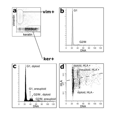 High Resolution Analysis Of Hla Class I Alterations In Colorectal