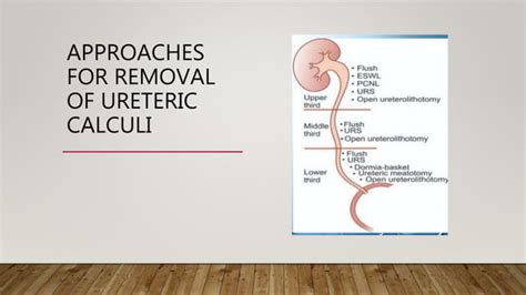 Ureteric Calculi Pptx Digestive Disorders Diseases And Conditions