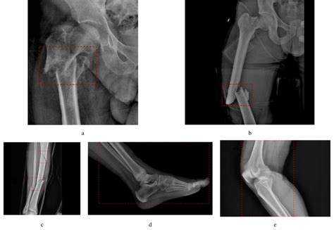 A B And C Are Examples Of Cases For Lower Limb Abnormalities