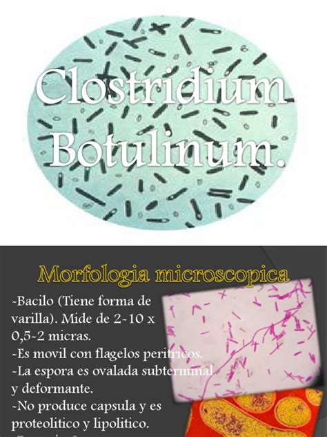 Clostridium Botulinum Salud Pública Medicina Clinica