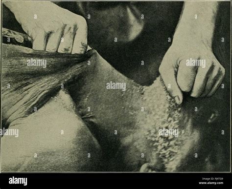 Postmortem Pathology A Manual Of The Technic Of Post Mortem Examinations And The