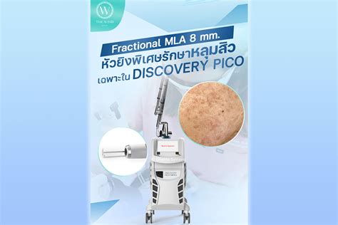 หัวยิงพิเศษรักษาหลุมสิวที่มีเฉพาะใน Discovery Pico