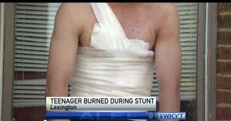 Dangerous Internet Challenge Involving Firearms Puts Teen In Critical