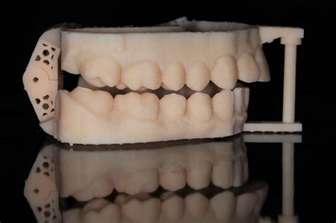 ¿cómo Imprimir Modelos Dentales 3d