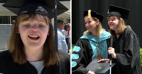 22 Year Old Woman Born Without Nose And Eyes Successfully Graduates