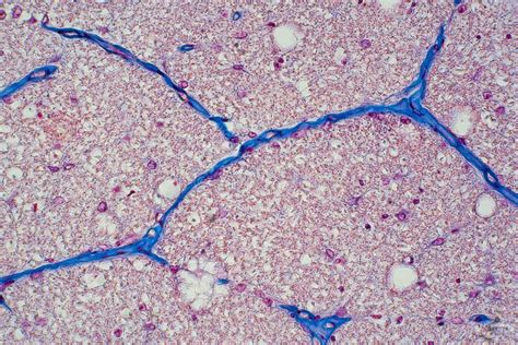 Nervio Del Ojo Humano Bajo Opini N Del Microscopio Foto De Archivo