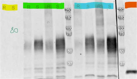 Why Do Hek Cells Degrade My Overexpressed Protein But Not Another