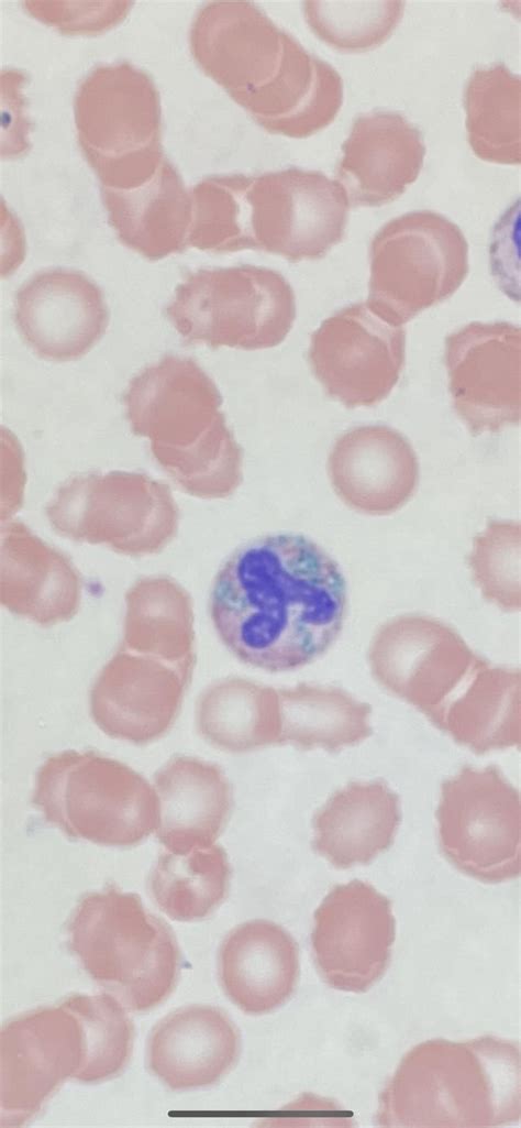 Wbc Green Crystals Rmedlabprofessionals