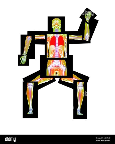 Whole Body Scans Coloured Magnetic Resonance Imaging Mri Scans Of A