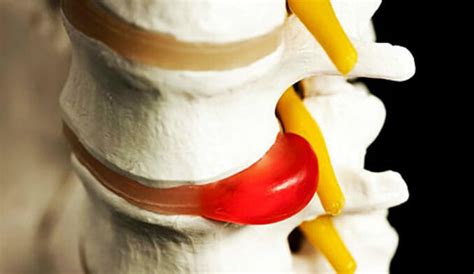 проф др Зафер Оркун Токташ Гръбначни заболявания