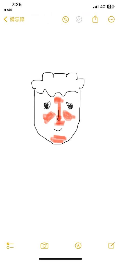 詢問 請益 臉上毛孔粗大伴有毛孔性角 醫美板 Dcard