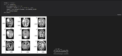 Brain Tumor Prediction مستقل