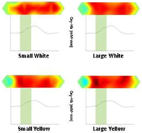 Brain Activity Maps And Time Series Waveforms Download Scientific Diagram
