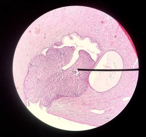 Cells In Reproductive Female Cytology And Histology Concept Stock Image