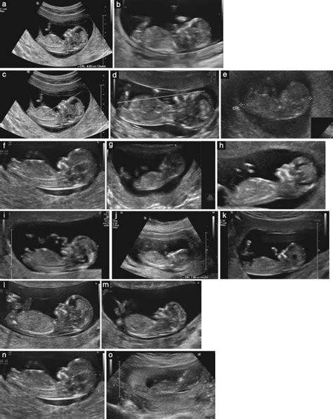 Examples Illustrating Image Scoring Criteria For Objective Assessment