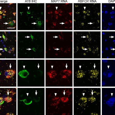 Fluorescent Rnascope Combined With Phosphorylated Tau At8 Download Scientific Diagram