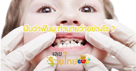 ฝันว่าฟันผุ ทำนายว่าอย่างไร พร้อมตีเลขเด็ด ดูคำทำนาย แม่น ๆ ได้ที่นี่