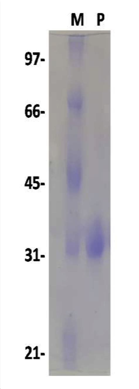 Sds Page Of The Purified Bacteriocin From Bacillus Subtilis Vs M