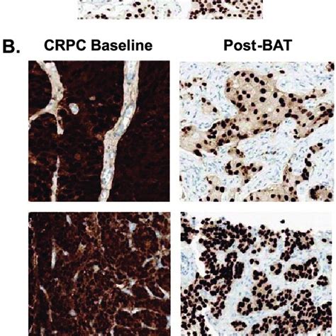 Trial Design Of The Transformer Study Download Scientific Diagram