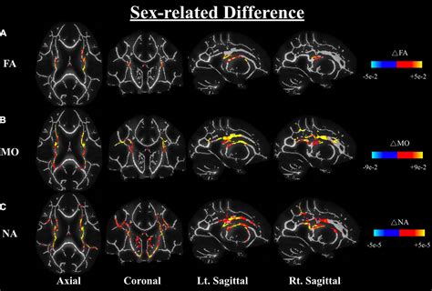 Frontiers Effect Of Sex On The Apoe4 Aging Interaction In The White