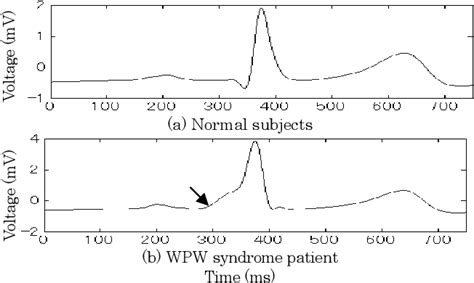 Figure 3 From Magnetocardiogram Analysis Using Imaginary Part Of