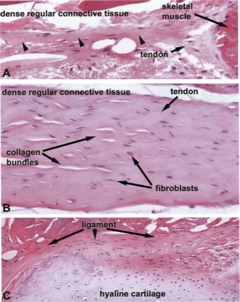 Connective Tissue Labeled