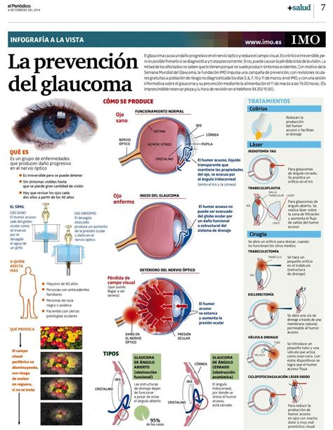 Pin de Cristhian Maria Jirón Aguirre en Oftalmo Cosas de enfermeria