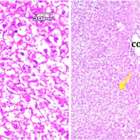 Light Micrograph Of A Reference Group Rat Liver Tissue Hande 100 Â 400