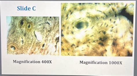 Solved Which Slide Goes With The Cells Of The Muscle