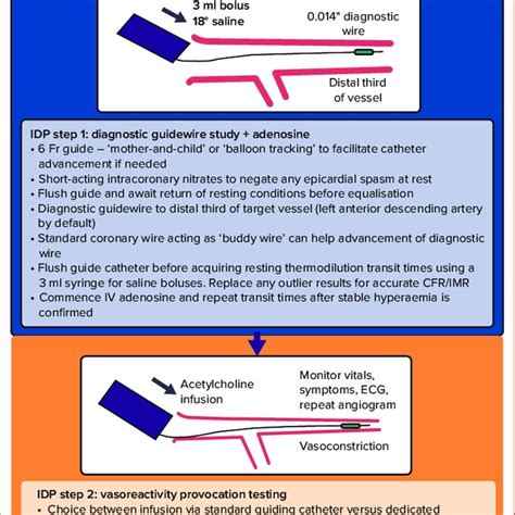 Interventional Diagnostic Procedure Workflow Download Scientific Diagram