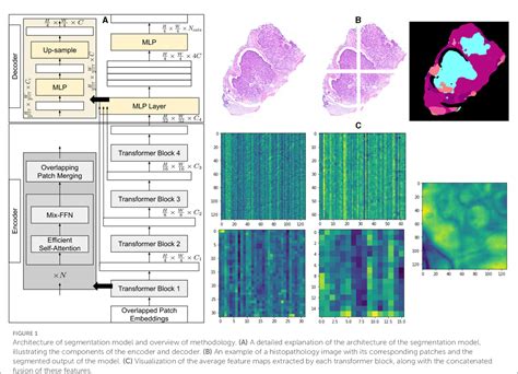 Figure 1 From Transformer Based Framework For Multi Class Segmentation