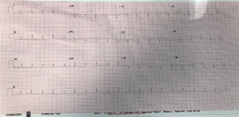 Case 1 Electrical Pulsus Alternans Download Scientific Diagram
